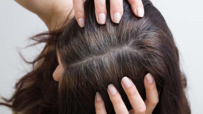 Generasi Z Mulai Ubanan di Usia Muda, Ini Penyebabnya dan Cara Mengatasinya - Tribun Gorontalo