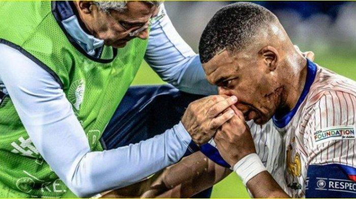 Pemain Baru Real Madrid Kylian Mbappe Patah Tulang Hidung saat Prancis Kalahkan Austria di Euro ...