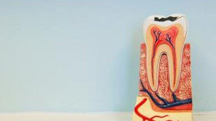 Terbukanya Jaringan Akar Gigi Bisa Disebabkan karena Terjadi Resesi ...