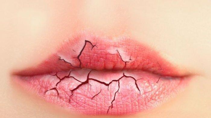 Sering Pakai Masker hingga Buat Bibir Kamu Kering? Yuk, Simak Cara ...