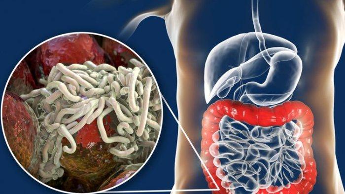 dr. S.T. Andreas, M.Ked(Ped), Sp.A Beberkan Komplikasi Kesehatan yang ...