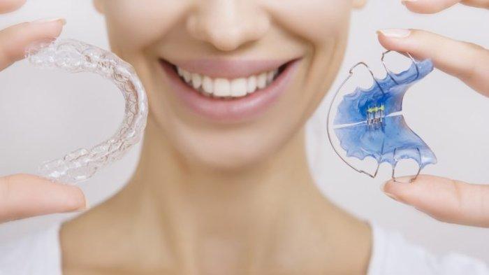 Informasi Lengkap Mengenai Retainer Gigi: Fungsi, Jenis, hingga Durasi ...