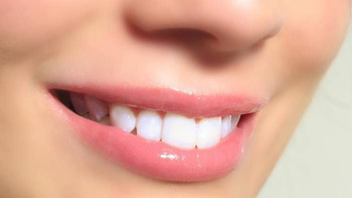 Gigi Mati: Kondisi pada Gigi yang tidak Menimbulkan Rasa Sakit pada ...