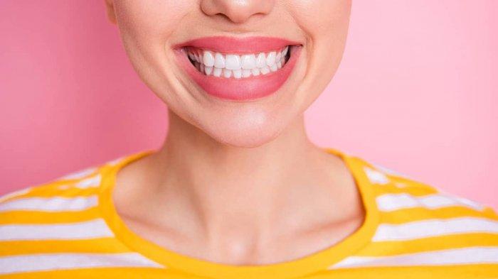 drg. Munawir : Perubahan Warna Gusi Menandakan Adanya Masalah Kesehatan ...