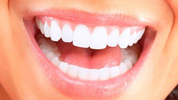 7 Tips Menjaga Gusi Sehat dan Kuat, Begini Caranya - TribunHealth.com