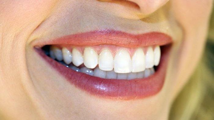 Warna Gusi Sehat adalah Merah Muda dan Merata di Seluruh Permukaannya ...