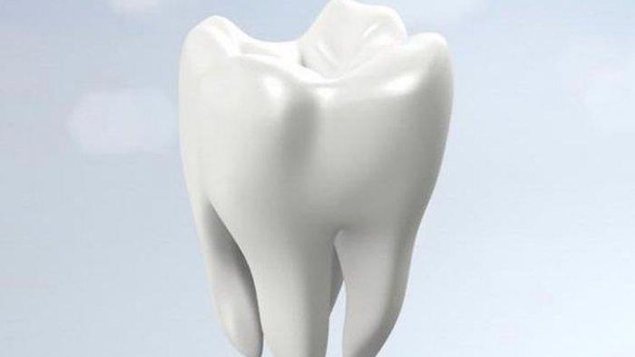 Begini Perbedaan Gigi Keropos dan Gigi Berlubang Menurut Dr. drg ...