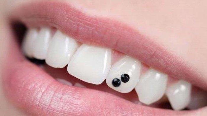 Apakah Pemasangan Berlian atau Hiasan Gigi Bisa Memengaruhi Kesehatan ...