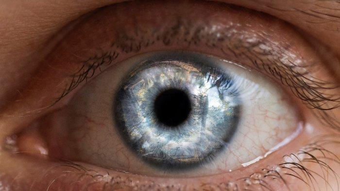 Dokter, Apakah Munculnya Warna Putih di Kornea Bisa Dikatakan Sebagai ...