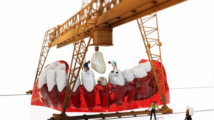 Pemasangan Alat Ortodonti Pasca Operasi Bedah Rahang Tidak Bisa ...