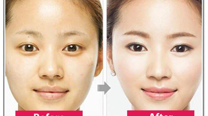 Dokter Kecantikan Jelaskan Upaya-upaya untuk Mendapatkan Wajah V-Shape ...