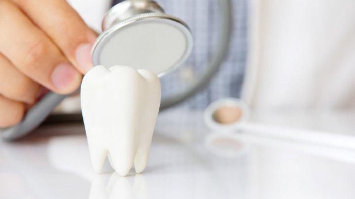 Perawatan Gigi yang Harus Dilakukan Meski Telah Menggunakan Veneer, Ini ...