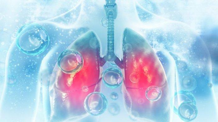 dr. Ginanjar Arum Desianti Paparkan Pemeriksaan untuk Mengetahui ...