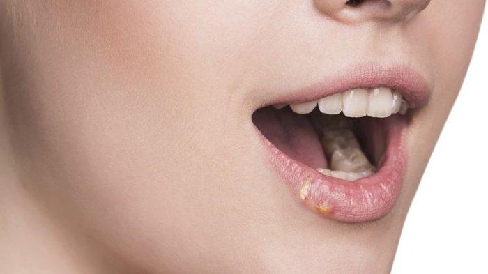 Apa yang Harus Dilakukan bila Mengalami Gejala atau Indikasi Infeksi ...