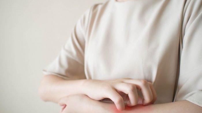 Nyamuk Malaria Hanya Mengigit di Malam Hari, Ketahui Penyebabnya dari ...