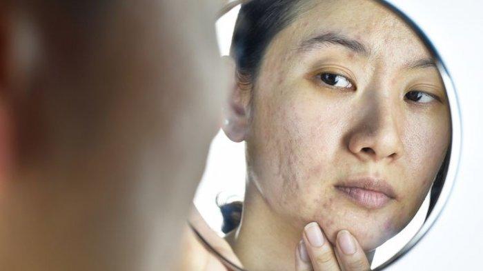 Dokter Kecantikan Beberkan Faktor-faktor yang Menyebabkan Kulit Menjadi ...