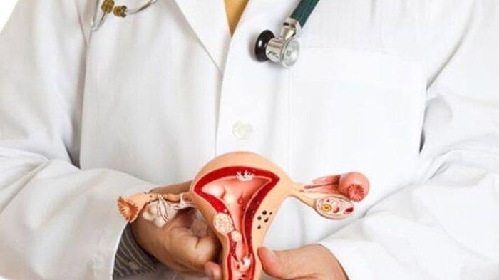 Gejala Apa yang Harus Diwaspadai Wanita Sedini Mungkin jika Mengalami Miom? - TribunHealth.com