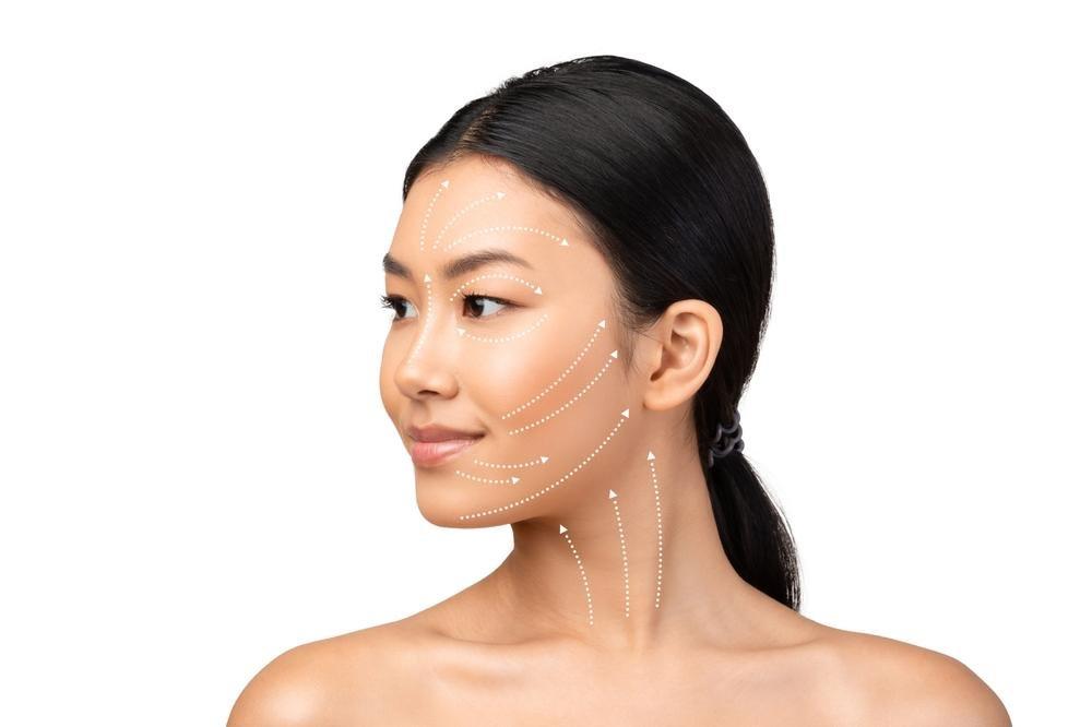 Thread Lift, Facelift, dan MMFU: Yang Mana Pilihan Tepat untuk Kulit Kencang dan Awet Muda ...