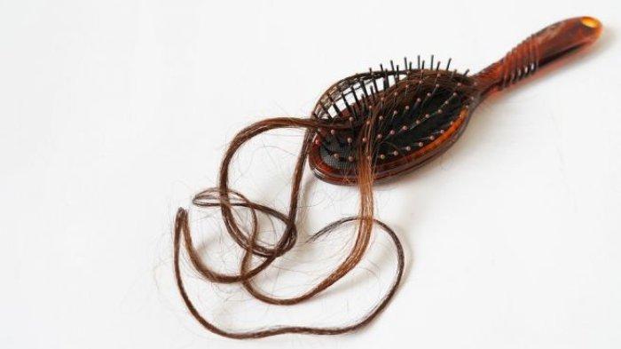 Treatment Mengatasi Rambut Rontok, Dokter: Bisa Melakukan PRP dan ...