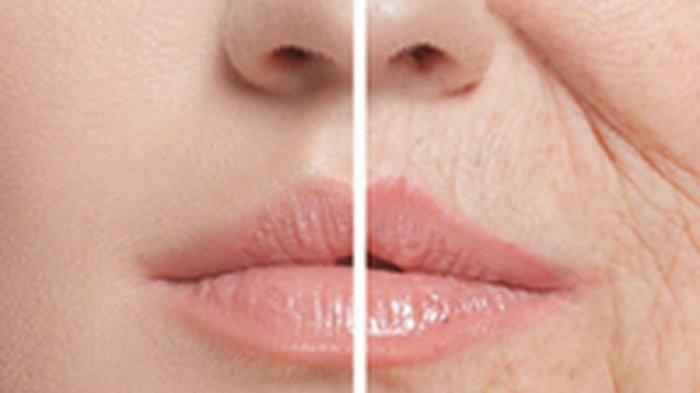 Ketahui Penyebab Rusaknya Kolagen dan Elastin pada Kulit, Ini Pemaparan ...