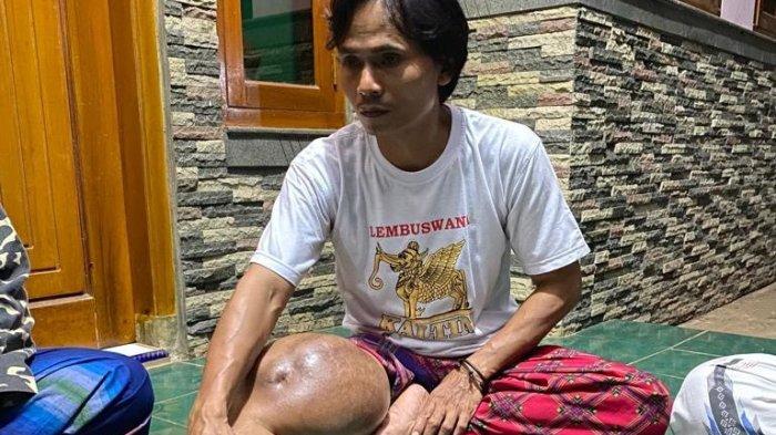 Berita Subang: Derita Tumor Ganas di Paha, Warga Pagaden Barat Minta ... Berita Subang: Derita Tumor Ganas di Paha, Warga Pagaden Barat Minta ...