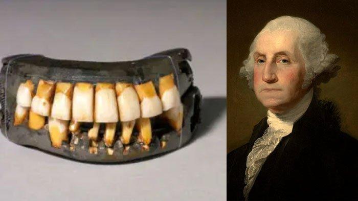 Presiden dengan Masalah Gigi Paling Brutal, Ada Gigi Palsunya yang ...