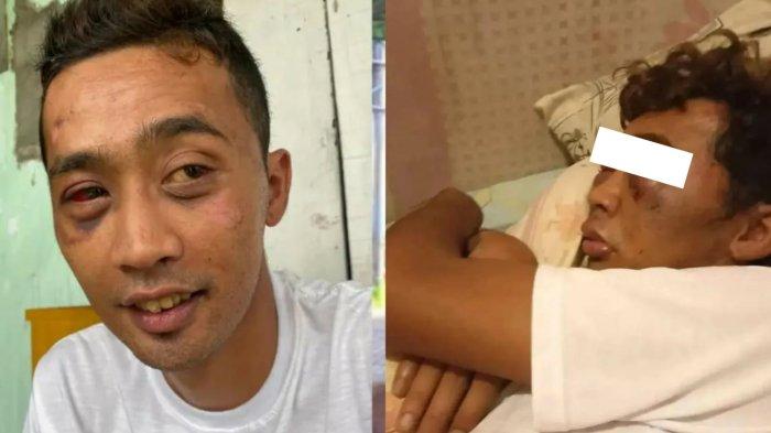 Viral, Nasib Pengamen Keterbelakangan Mental Dikencingi dan Dipukul ...