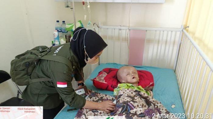 Kondisi M Ziban Bocah Penderita Hidrosepalus di Indramayu Diketahui ...