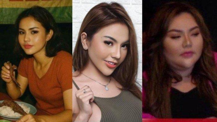 Perubahan Wajah Lisa Mariana Disebut Sebelum Oplas dan Kenal Ridwan Kamil, Foto Lawasnya Disorot ...