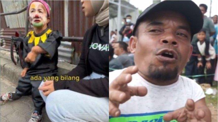 Viral Kisah Joni Badut Difabel Ngaku Ditinggal Ucok Baba Setelah ...