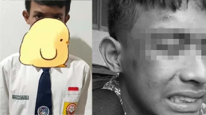 Viral, Pelajar SMP di Depok Mendadak Linglung Usai Pulang Study Tour ...