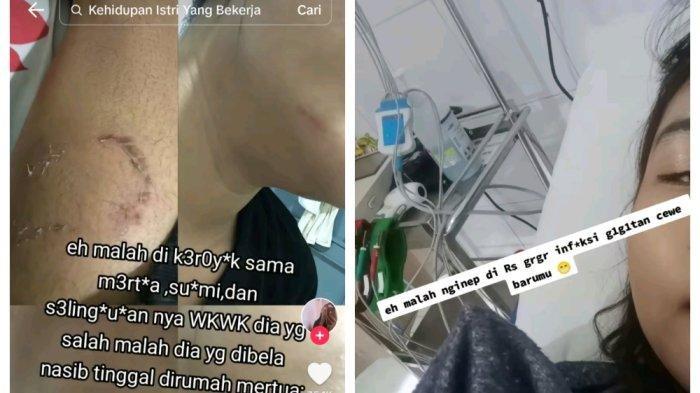 Viral Kisah Si Eneng Pergoki Suami Selingkuh, malah Digigit Pelakor sampai Infeksi dan Masuk RS ...