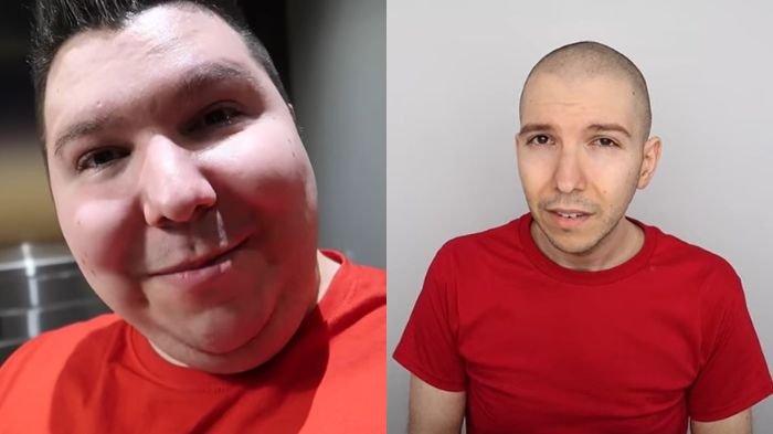 Sosok Nikocado Avocado, YouTuber Mukbang yang Turun Berat Badan 113 Kg ...