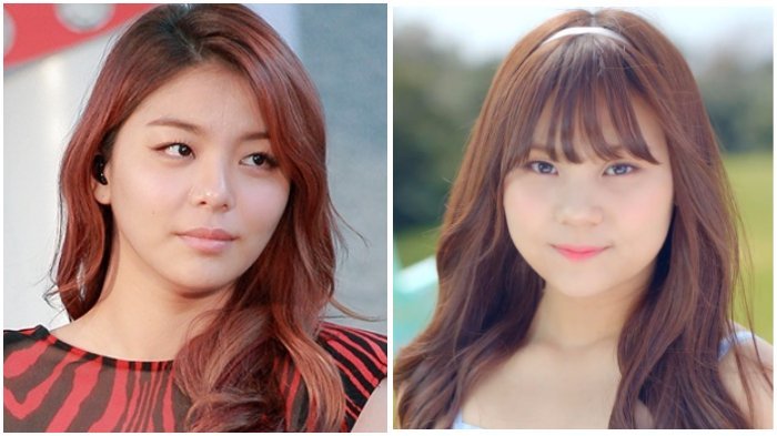 Ailee Plastic Surgery Before And After
