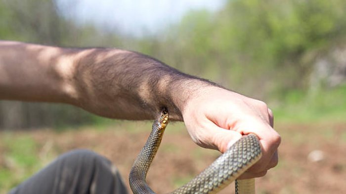 Cara Paling Tepat Menolong Korban Digigit Ular, Mudah dan Disertai ...
