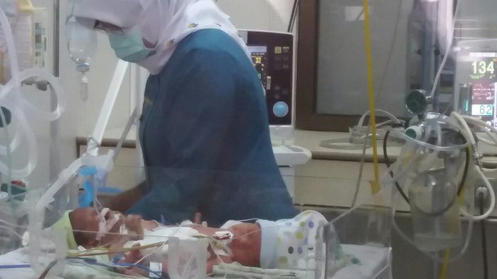 Ini Alasan Bayi Kembar Siam, Malik dan Gani, Tidak Bisa Bertahan Hidup Pascaoperasi - Tribunjabar.id