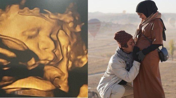 Lesti Hamil Besar, Awal Tahun Depan Diprediksi Lahiran, Istri Rizky ...
