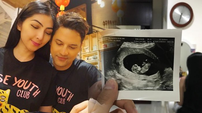 Baru Umumkan Kehamilan Sang Istri, Kini Aktor Tampan Ini Bawa Kabar ...