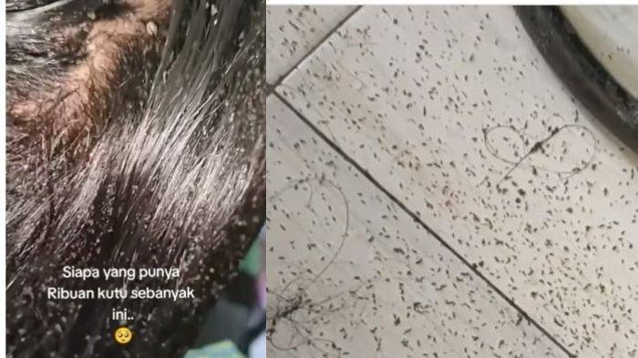 Viral Penampakan Ribuan Kutu yang Bersarang di Rambut Anak Perempuan, Begini Penjelasan Dokter ...