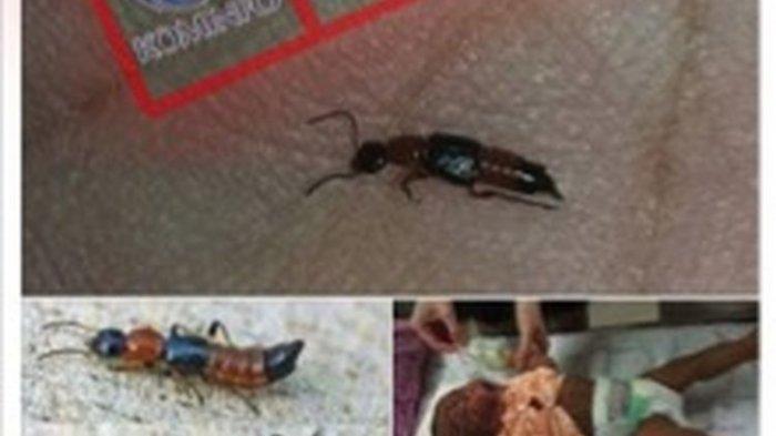 Mengenal Tomcat, Serangga Kecil yang Racunnya Berbahaya Jika Kena Kulit ...