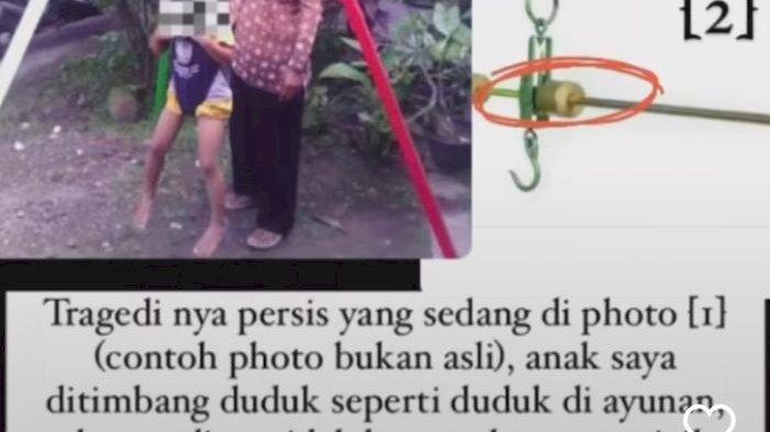 Viral di Media Sosial, Balita Tertimpa Timbangan Besi Gantung di Posyandu, Kepalanya Bocor ...