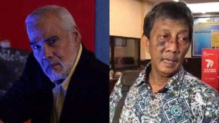 Artis Senior Pierre Gruno Ternyata Naik Pitam Cuma Karena Hal Sepele ...