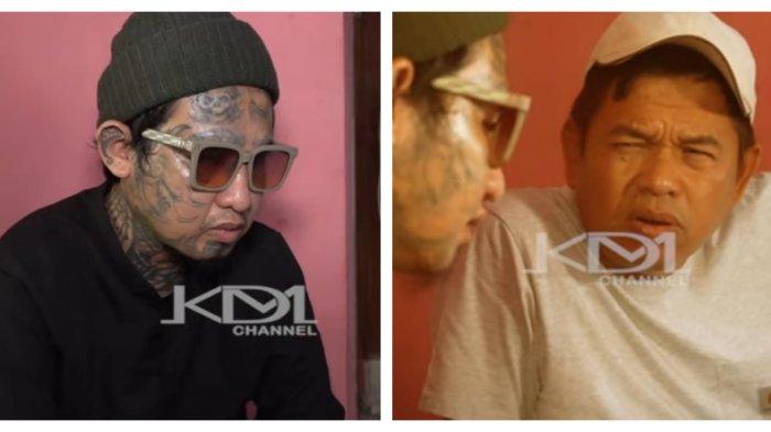 Faisal Korban Congkel Mata di Gunung Putri Ngaku Belum Dapat Keadilan ...