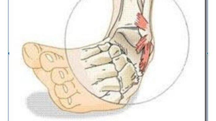 Nyeri Saat Menggerakan Pergelangan Kaki, Bisa Jadi Tanda Cedera Ankle ...