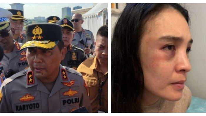 Irjen Karyoto Ungkap Alasan Kasus KDRT di Depok Terlihat Tak Berimbang: Suami Istri Layak ...