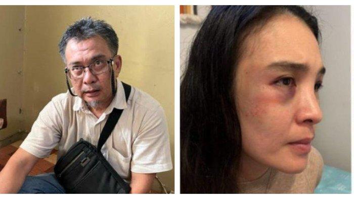 Berkat Sang Cucu, Noviansyah Tahu Tabiat Menantu Kerap KDRT Putrinya ...