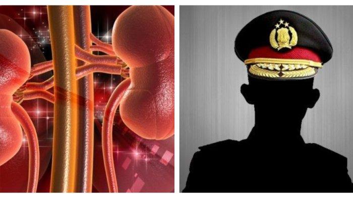 Terkuak Dua Peranan Aipda M di Kasus Penjualan Ginjal ke Kamboja, Pantas Jadi Sulit Terlacak ...