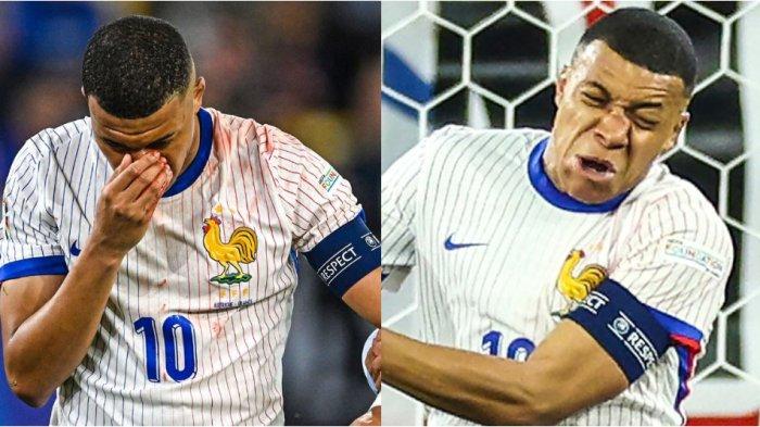 Tragedi Mengerikan Euro 2024: Prancis Belum Panas, Kylian Mbappe Berdarah-darah Kondisi ...