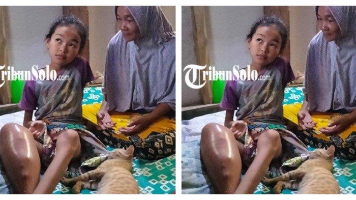 Hati Penjual Cilok Tersayat Lihat Putri Merintih Kesakitan: Kaki ...
