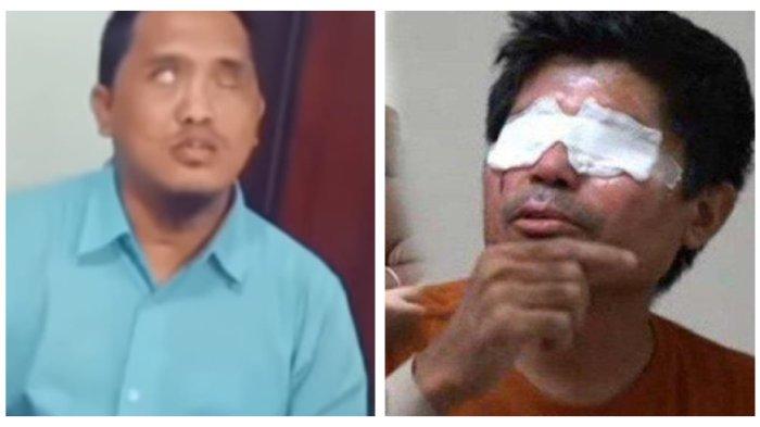 Tuna Netra Ini Bisa Hidup Tanpa Donasi, Beri Kritikan Menohok ke Agus ...